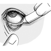 Eye procedures | RPHCM