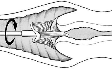 Genital examination — female | RPHCM