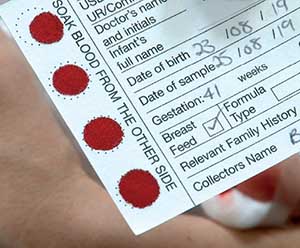 Newborn screening test | RPHCM