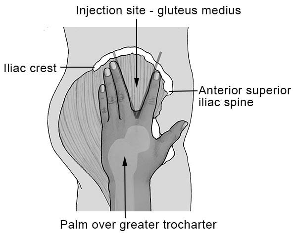 Giving injections | RPHCM