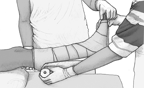 Plaster of Paris (POP) slabs | RPHCM