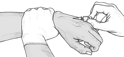 Putting in IV cannula and starting a drip | RPHCM