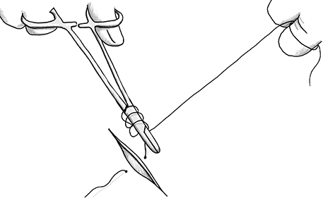 Closing a wound | RPHCM