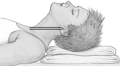 Keeping airway open and assisting breathing | RPHCM