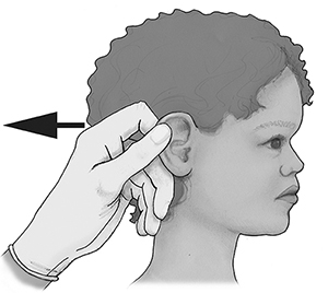 Ear examination | RPHCM