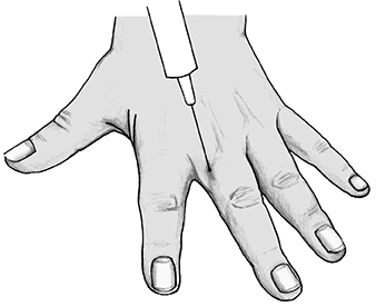 Nerve and ring blocks | RPHCM