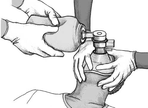 308 Permanent Redirect