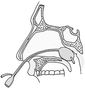 Nasal packing | RPHCM