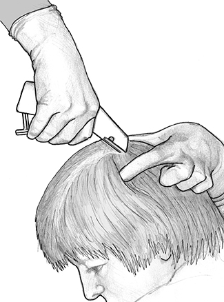 Closing a wound | RPHCM