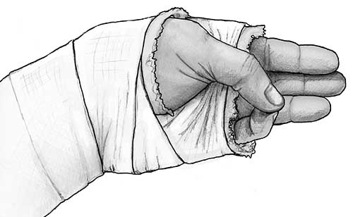 Plaster of Paris (POP) slabs | RPHCM