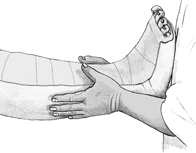 Plaster of Paris (POP) slabs | RPHCM