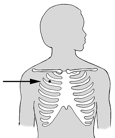 Chest procedures | RPHCM