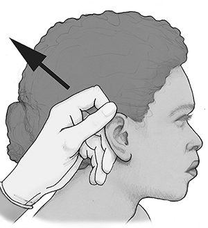 Ear examination | RPHCM