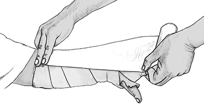 Plaster of Paris (POP) slabs | RPHCM