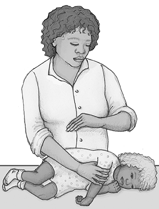 Chest physiotherapy | RPHCM