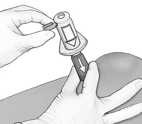 Putting in intraosseous needle | RPHCM