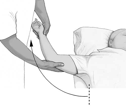 Reducing dislocated or pulled joints | RPHCM