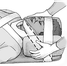 Immobilising the spine | RPHCM