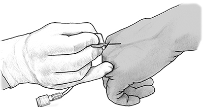 Putting in butterfly IV needle | RPHCM