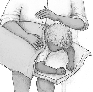 Chest physiotherapy | RPHCM