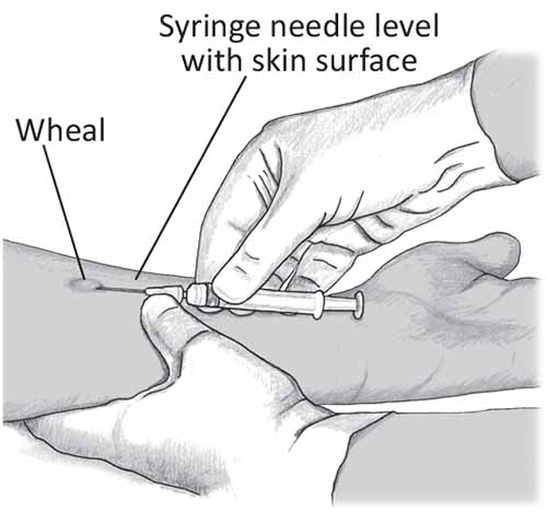 Giving injections | RPHCM