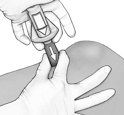 Putting in intraosseous needle | RPHCM