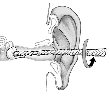 Ear procedures | RPHCM