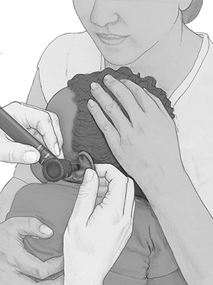 Ear examination | RPHCM