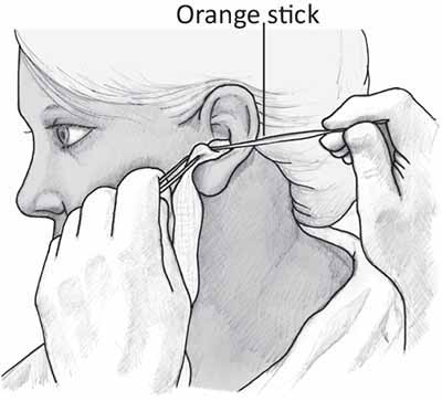 Ear procedures | RPHCM