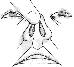 Collecting swabs | RPHCM