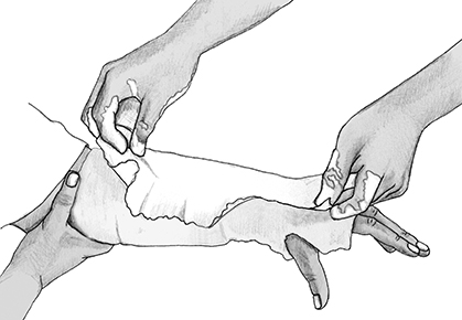 Plaster of Paris (POP) slabs | RPHCM