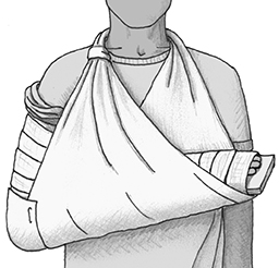 Immobilisation for a snake bite | RPHCM